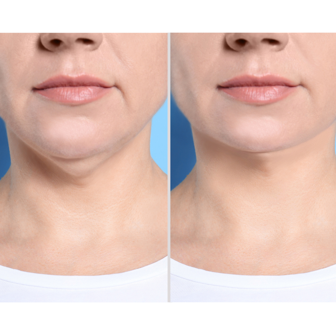 Don't Neglect The Neck – Artisan Aesthetics